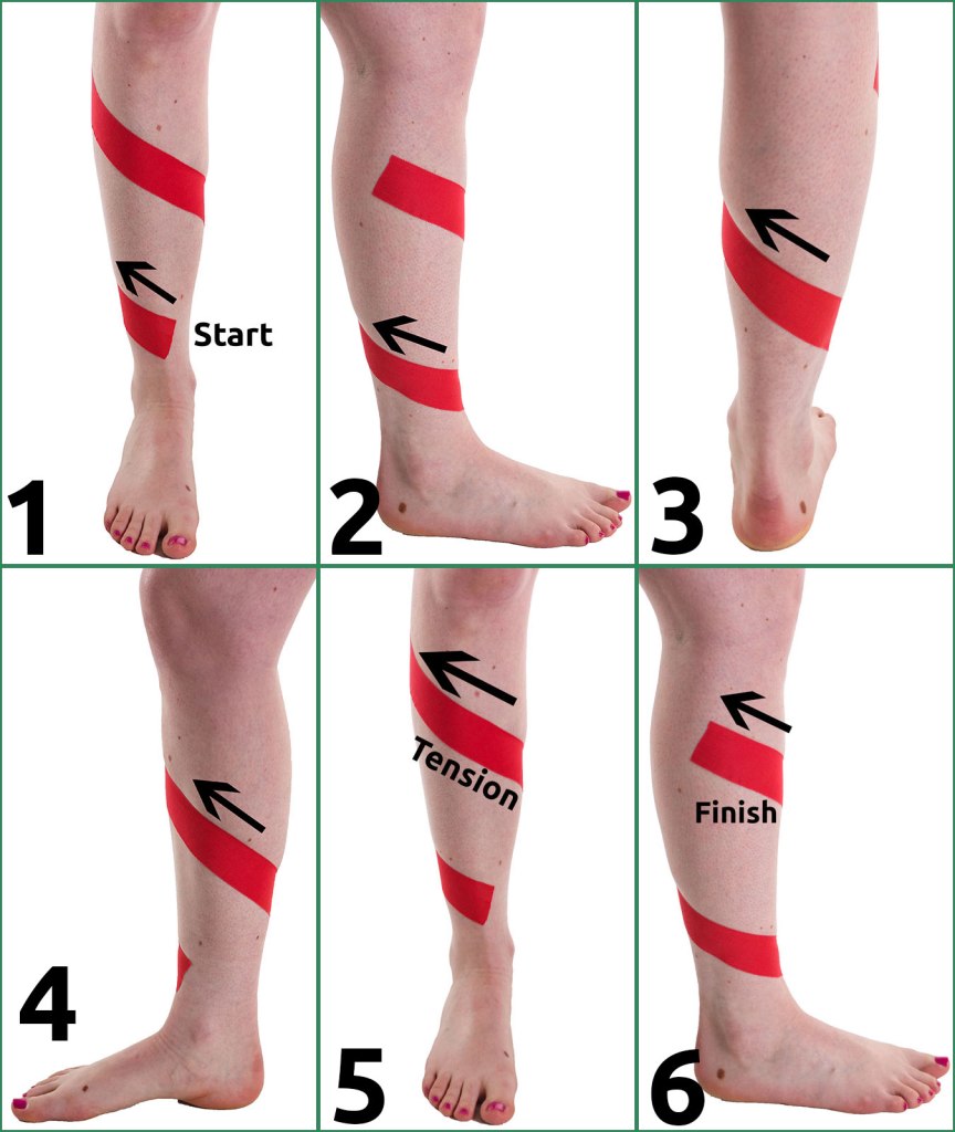 Taping for Shin Splints | Physical Sports First Aid Blog