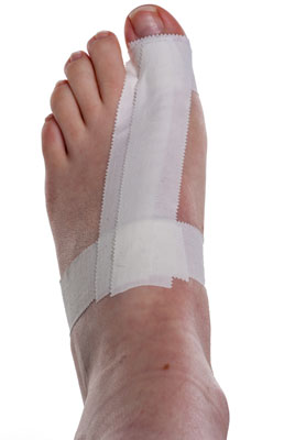 Turf Toe Taping | Physical Sports First Aid Blog