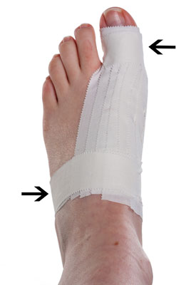 Turf Toe Taping | Physical Sports First Aid Blog